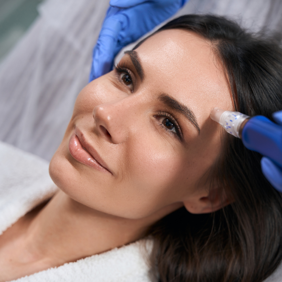 SkinPen - The Dermatology Group | Dermatology